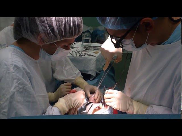 Трансплантация почки