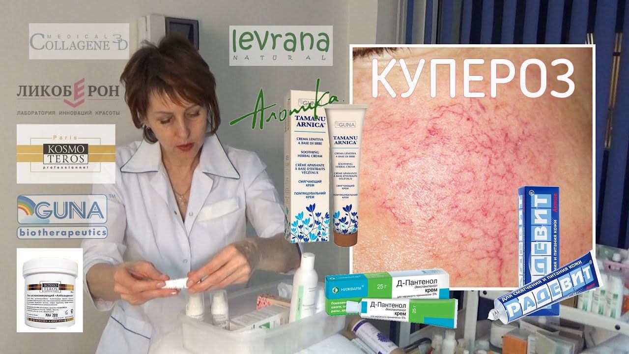 Купероз + куча других проблем - как быть? Кремы от купероза.