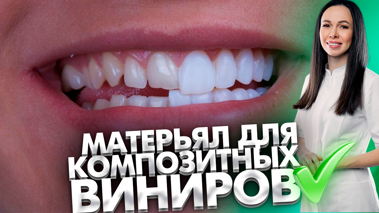 Для постановки композитных виниров используются специальные материалы? Стоматология в Сочи.