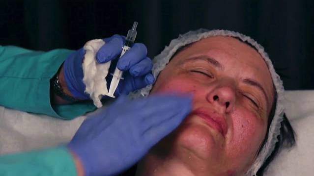 PRXT33+Dermapen+mesoroller