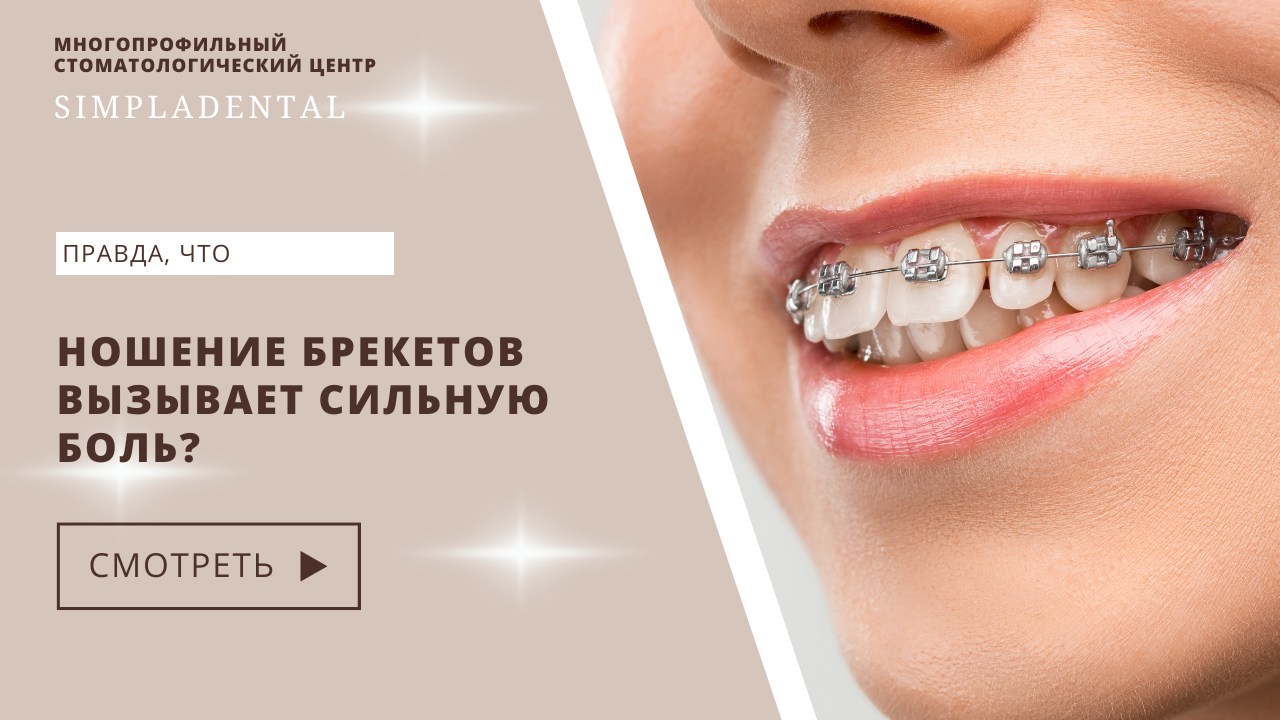 Правда, что ношение брекетов вызывает сильную боль?
