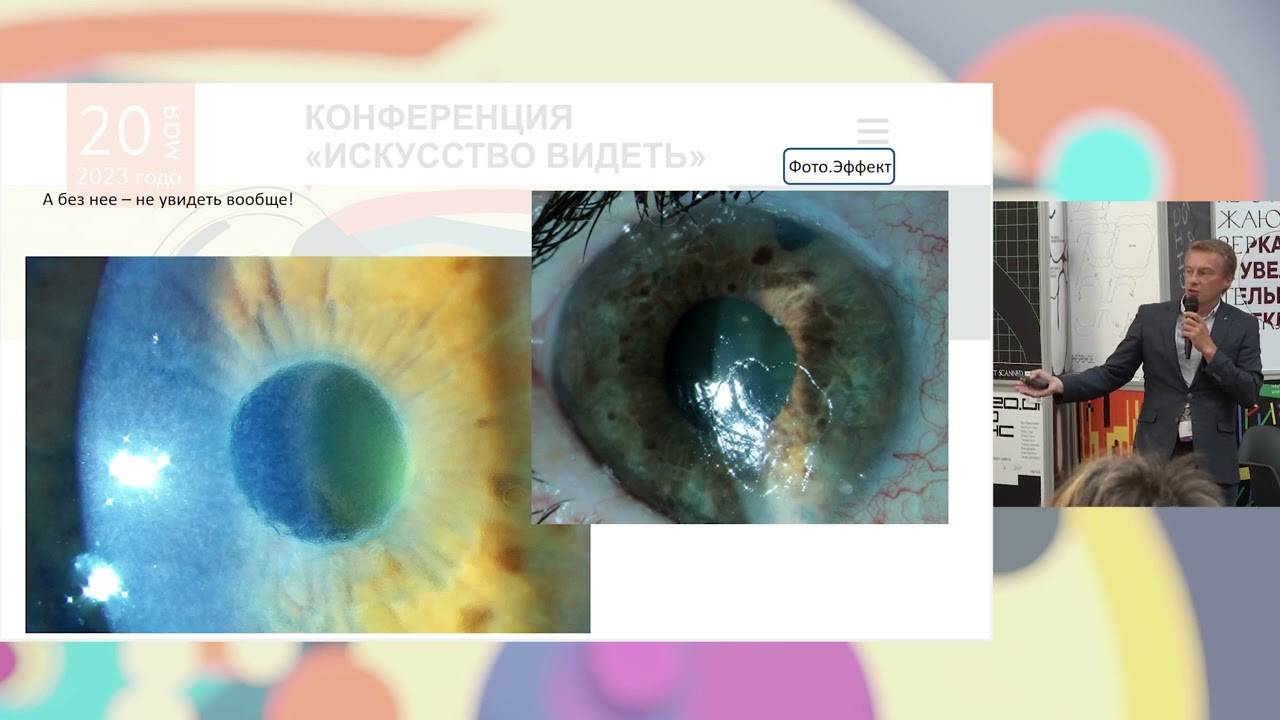 Глаз и космос: фотовидеорегистрация глаза человека | Искусство видеть 2023