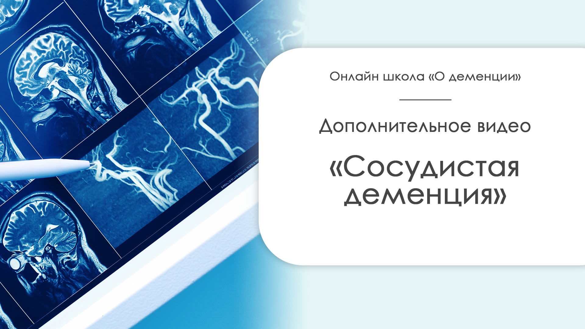 Виды деменции. Сосудистая деменция.