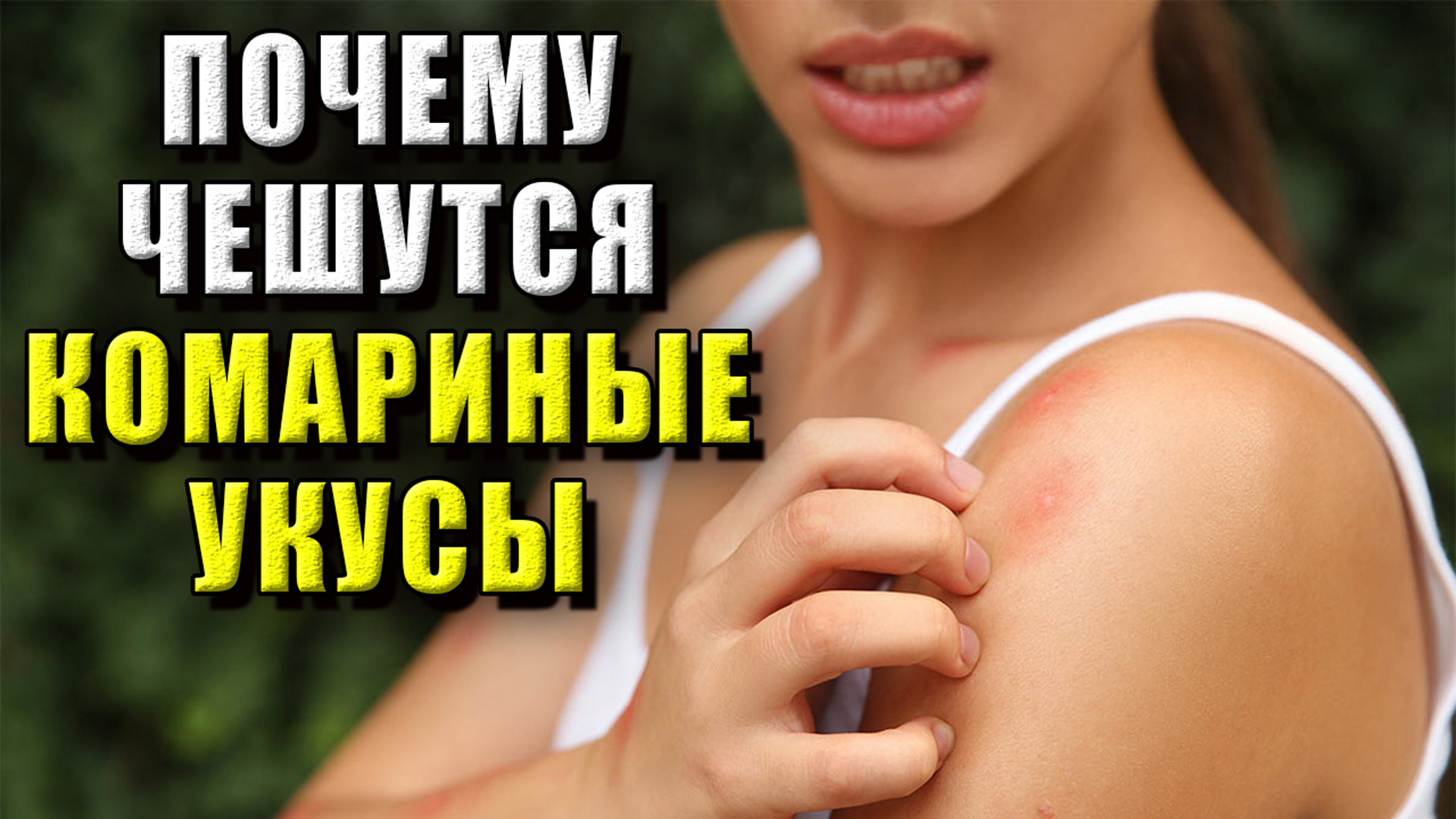 Почему чешутся комариные укусы