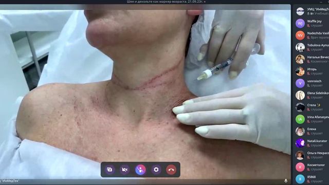 Шея и декольте как маркер возраста. Филлеры XSPURT