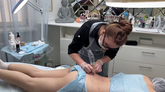 ВИТИЛИГО/ ПОМОГЛИ УБРАТЬ ПЯТНА