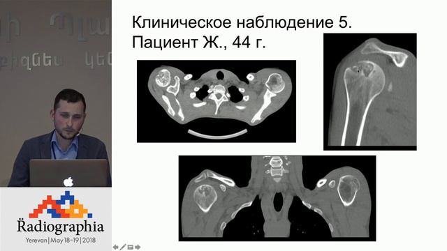 Tb or not tb? This is the question. Туберкулез или не туберкулез? Павел Зельтер