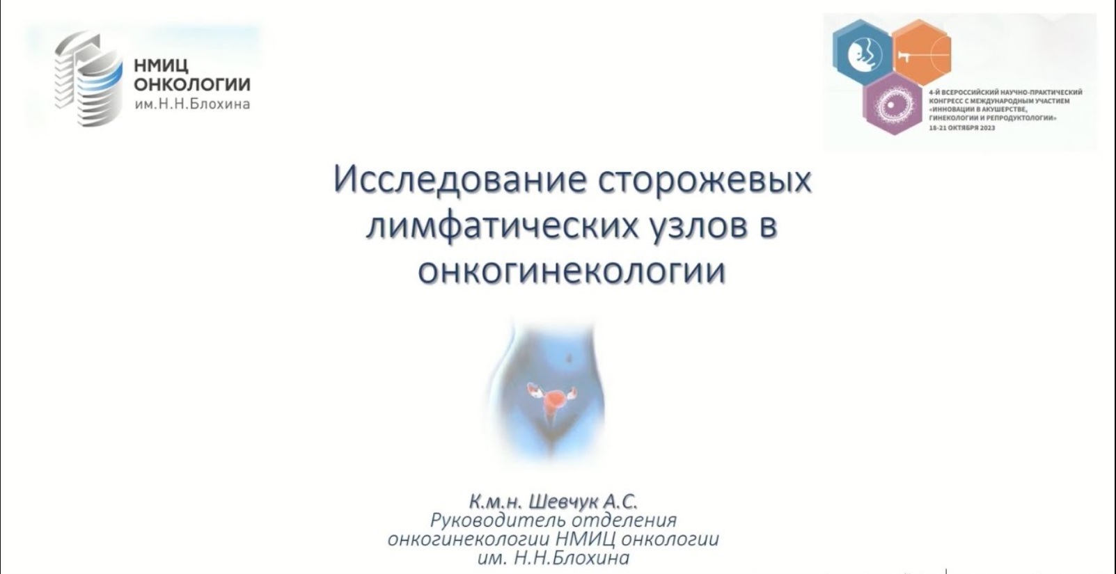 Исследование сторожевых лимфатических узлов в онкогинекологии