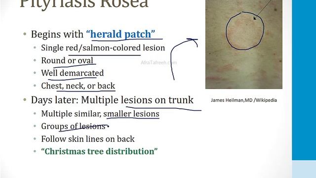 Дерматология USMLE - 1. Общее - 4.Кожные заболевания II