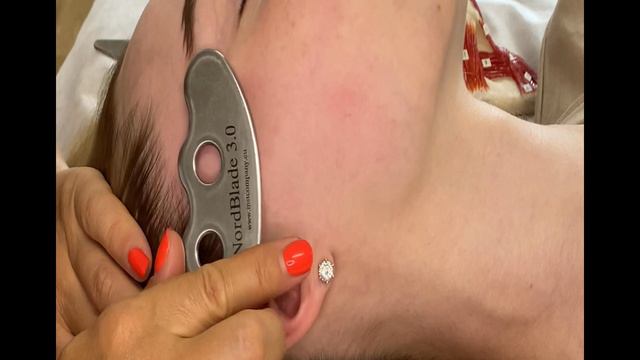 Височная зона головы. Массаж лица. Инструментальный массаж NordBlade. Специалист: Вера Соболевская.