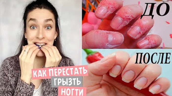 КАК ПЕРЕСТАТЬ ГРЫЗТЬ НОГТИ(КУТИКУЛУ)?/Несколько способов избавиться от вредной привычки/СОВЕТЫ