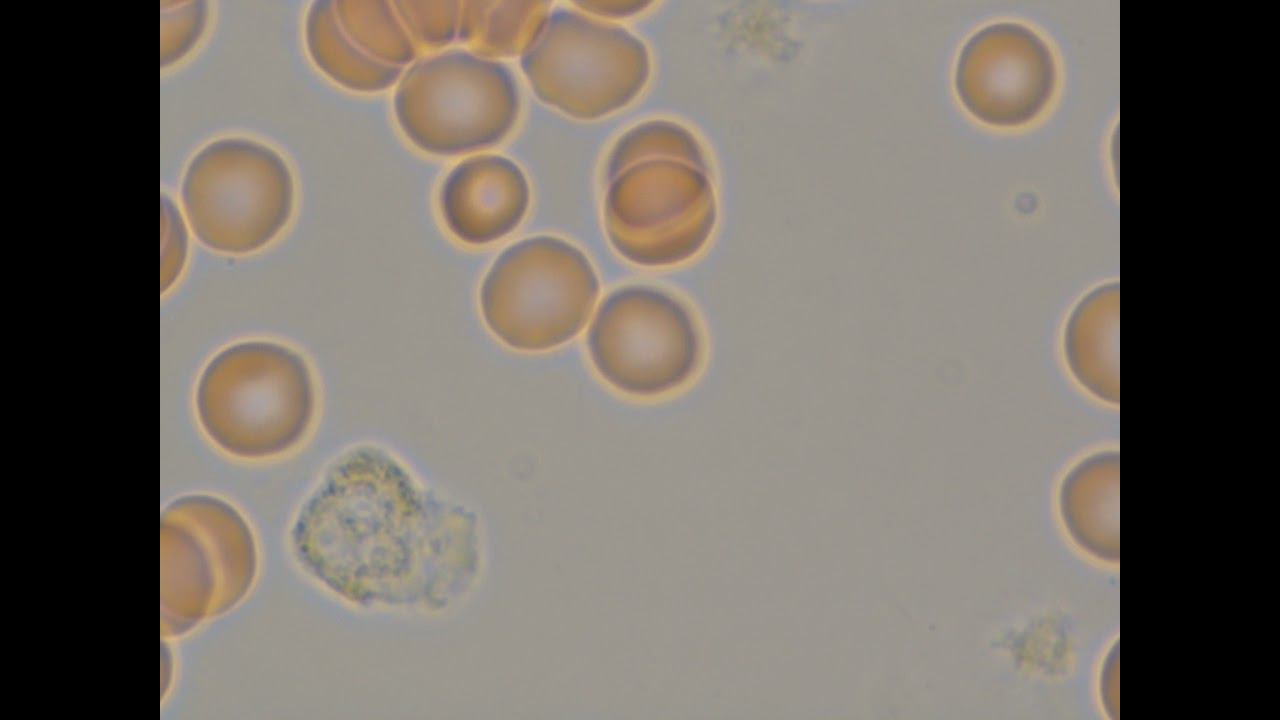 Гранулоцит нейтрофильный малоподвижный, палочковидная бактерия под микроскопом Микмед 6 в 7