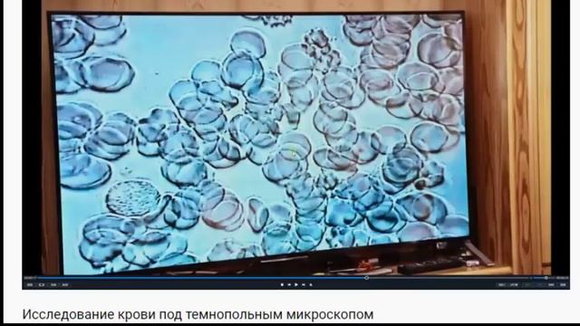 Катушки Мишина и энергетическое здоровье человека. Влияние катушек Мишина на кровь.