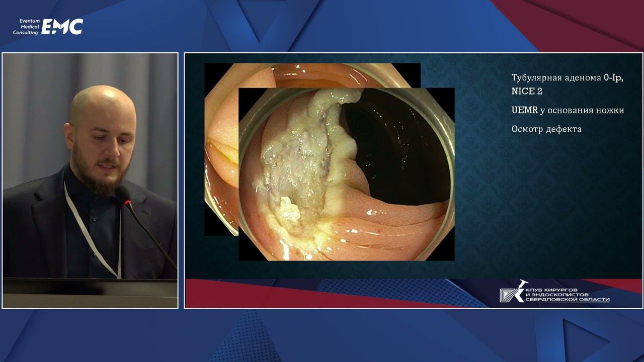 4. Подводная эндоскопическая резекция слизистой (uEMR) — Першин М.П.