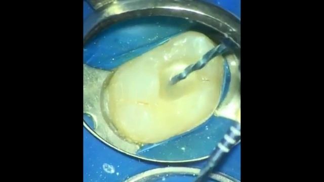 2020_06_30_Механическая инструментария. Файлы, калибраторы и этидроновая кислота..mp4