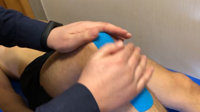Наложение кинезио тейпа на связку надколенника.Болезнь ОсгудаШляттера, тендинит связки надколенника.