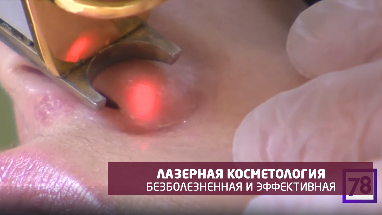 Лазерная косметология - безболезненная и эффективная