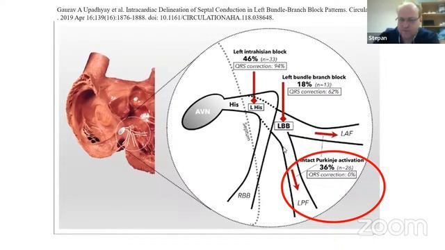 Основы физиологической стимуляции Сердца. ЭКГ при стимуляции пучка Гиса и области ЛНПГ