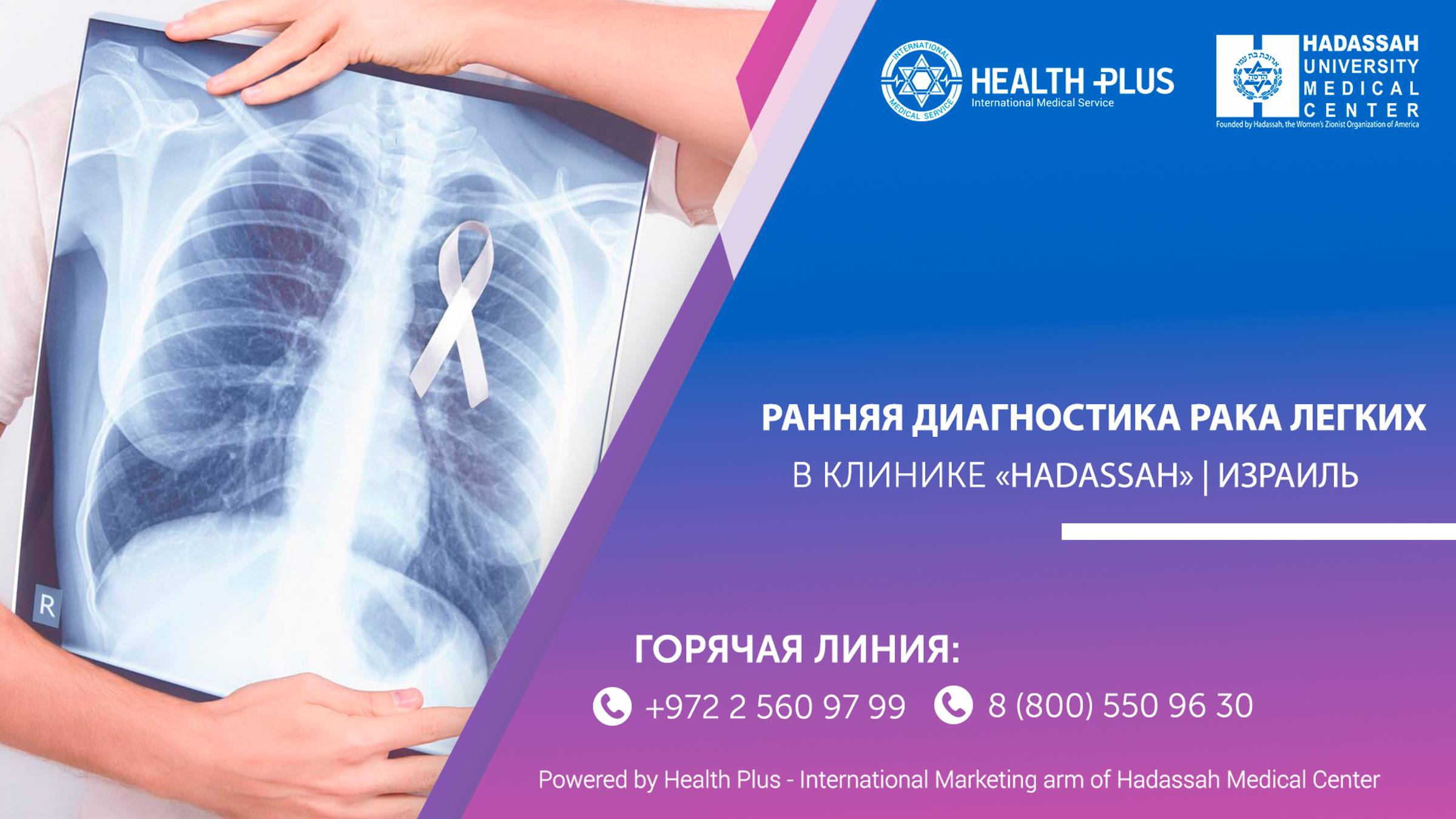 Ранняя диагностика рака легких в израильской клинике Хадасса