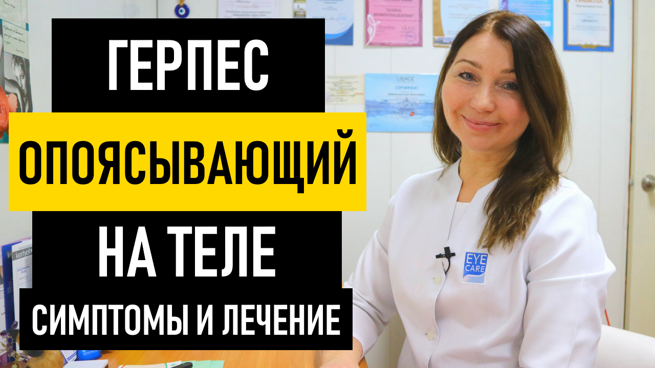 Опоясывающий герпес: симптомы и лечение у взрослых. Чем и как лечить опоясывающий герпес на теле