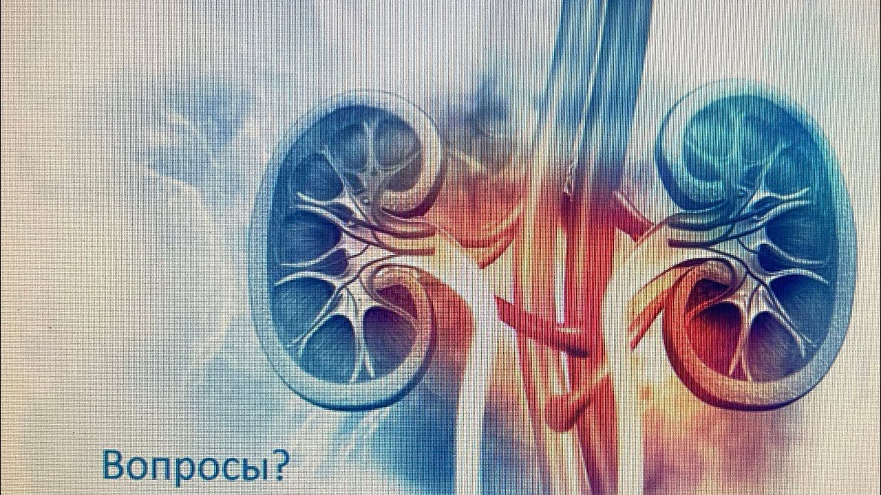 Я эксперт  /нет/