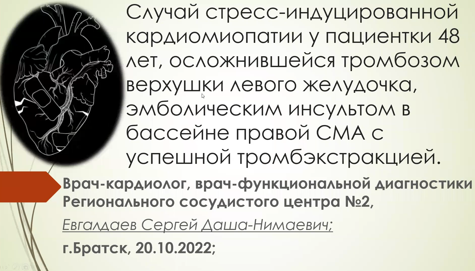 Случай стресс-индуцированной кардиомиопатии