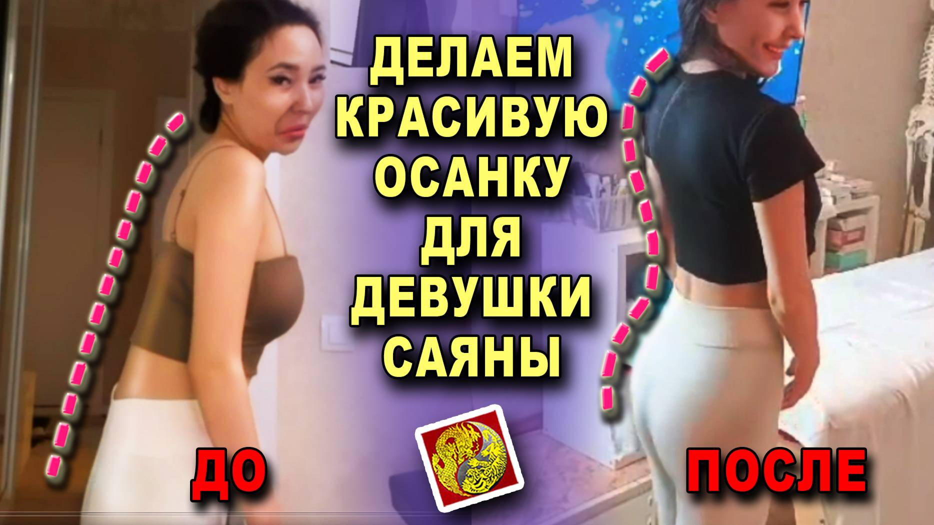 Делаем красиввую осанку девушкам. Саяна, сеанс №2. Обучение мануальной терапии у Олега Гудвина