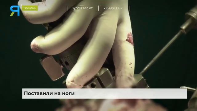 Врачи ОКБ №1 поставили жительницу Ноябрьска на ноги