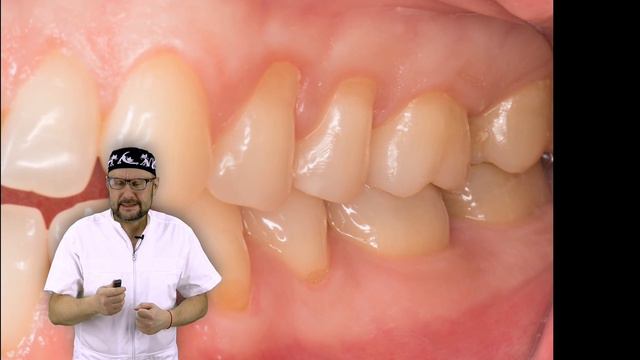 Смотрите полное видео этого клинического случая на сайте EDRANOVNMO.RU