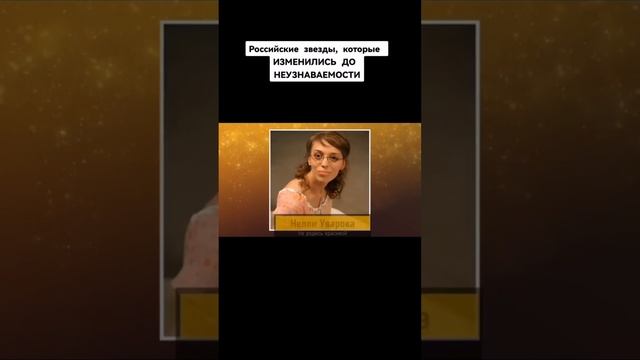 Росийские звёзды,которые изменились до неузноваемости