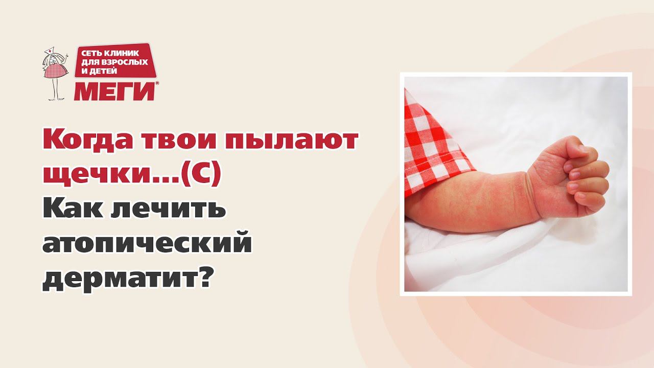 Когда твои пылают щечки…(С) Как лечить атопический дерматит?