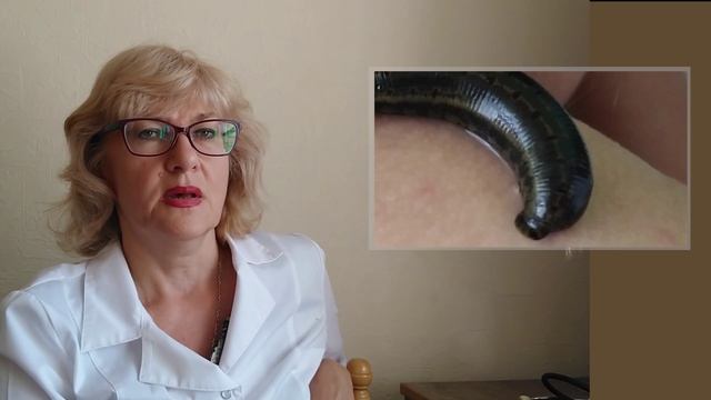 Гирудотерапия Санаторий имени Ленина курорт Ундоры