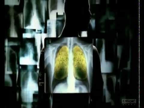 ОБЩЕЕ ДЕЛО Откажись от курения сегодня БРОСИТЬ КУРИТЬ БЫТЬ ЗДОРОВЫМ УСПЕШНОСТЬ