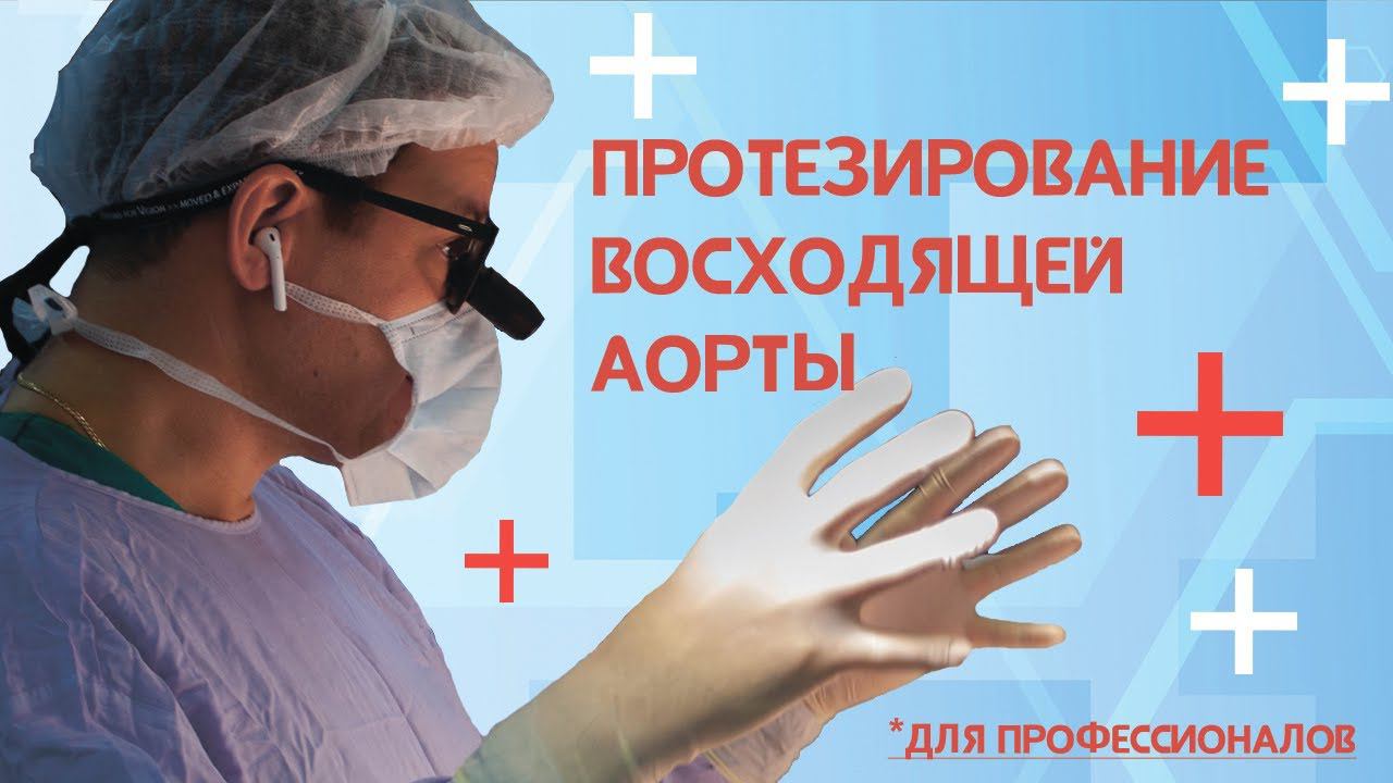 Протезирование восходящей аорты в сочетании с экстирпацией матки (для профессионалов)