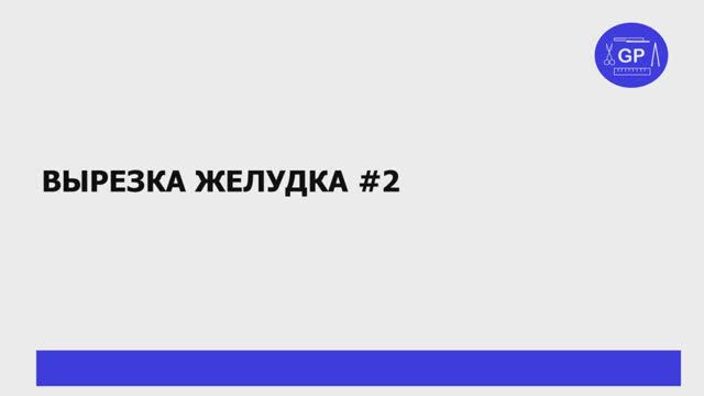 Рак желудка - гистологическое исследование (вырезка) #2