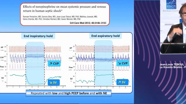 Norepinephrine may help reduce the fluid balance Jean-Louis Teboul