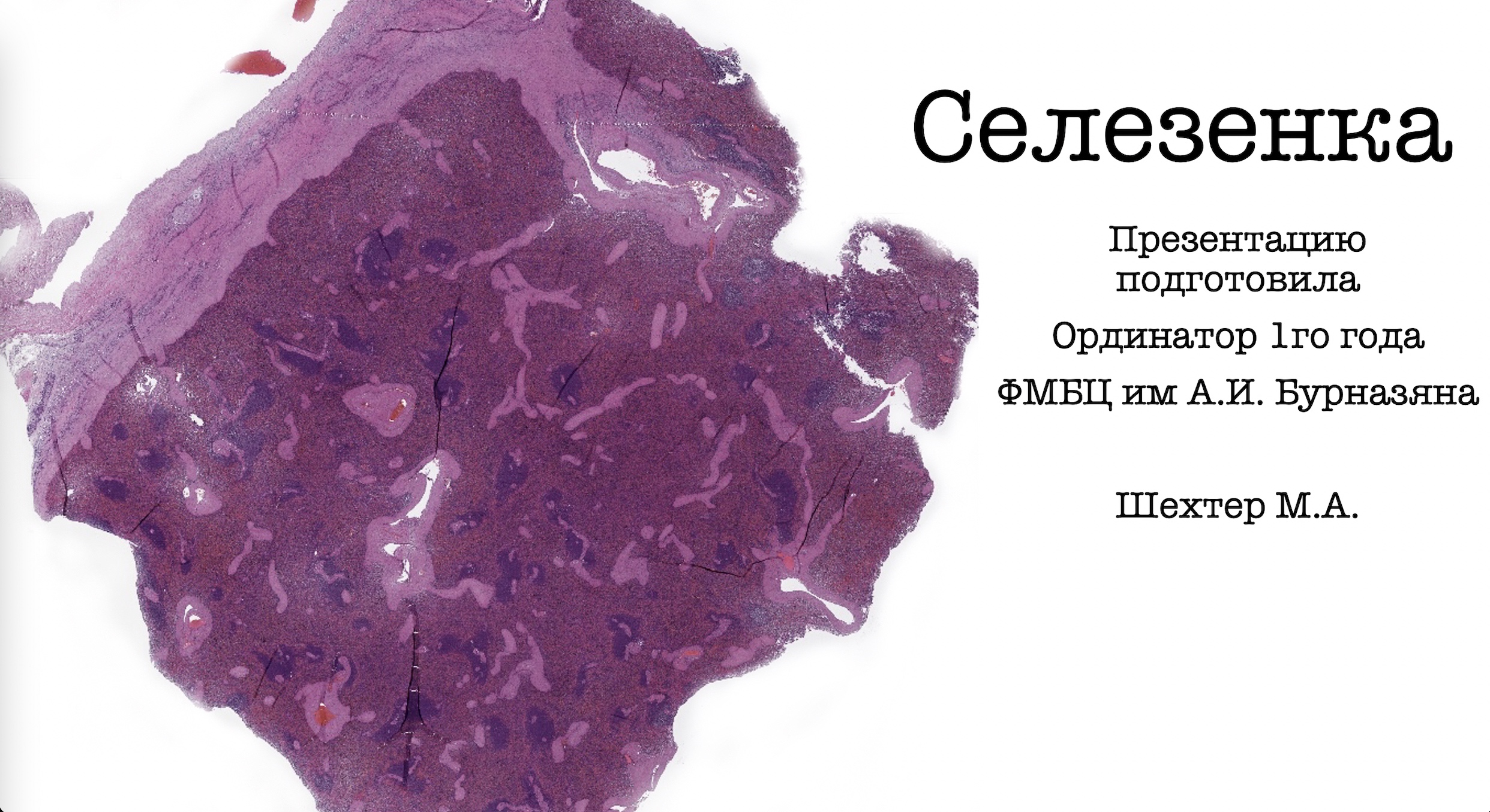 Селезенка. Нормальная гистология