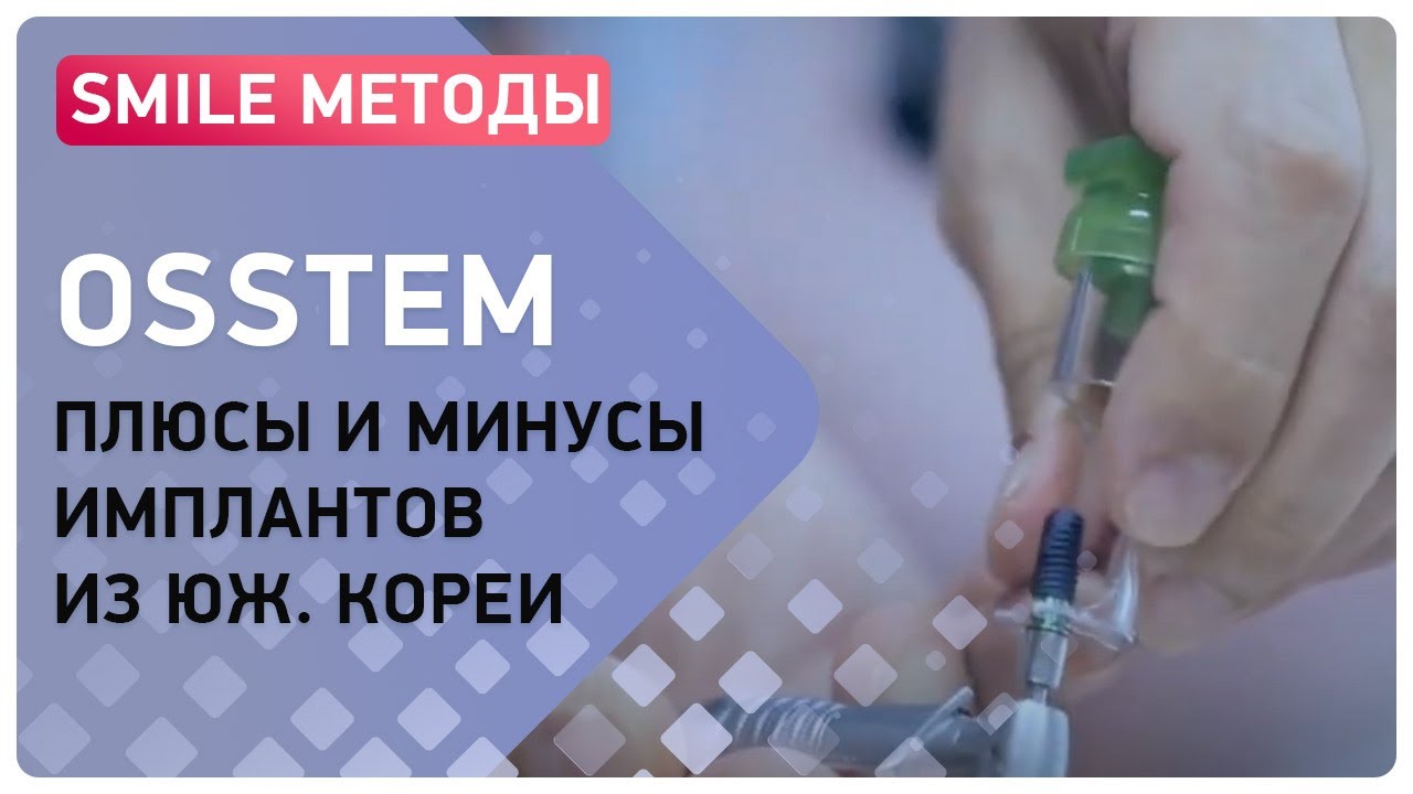 Импланты Osstem из Южной Кореи: обзор бренда
