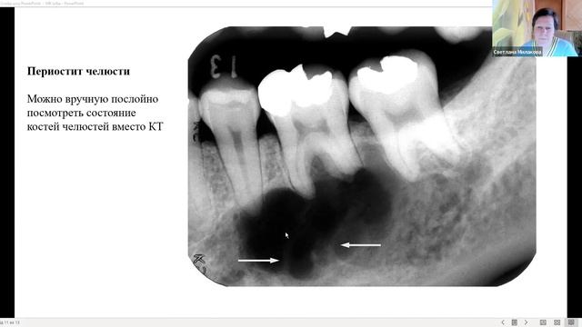 Фрагменты мастер-класса "Зубы"