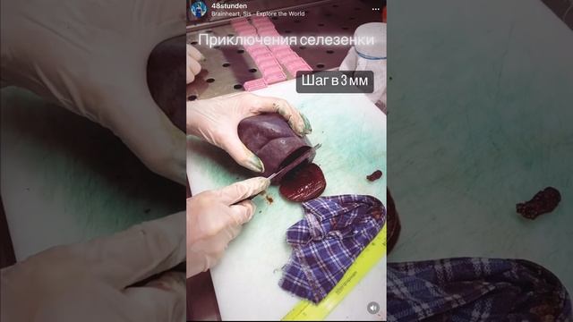 Приключения селезенки