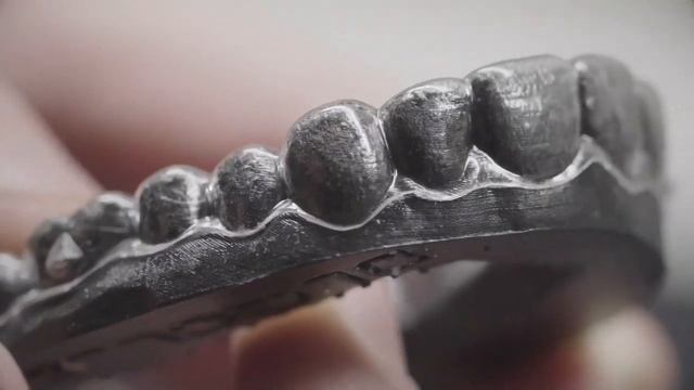 Как делают каппы для выравнивания зубов | Элайнеры