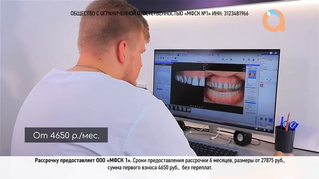 Коронки из диоксида циркония в рассрочку, в клинике Атмосфера в Белгороде