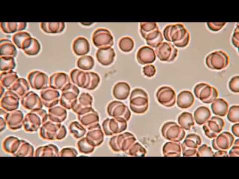 Визуализация гемосканирования с помощью цифровых USB микроскопов и ПО Дианел-микро