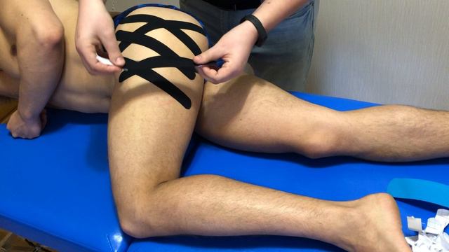 Наложение кинезио тейпа при болях в тазобедренном суставе.