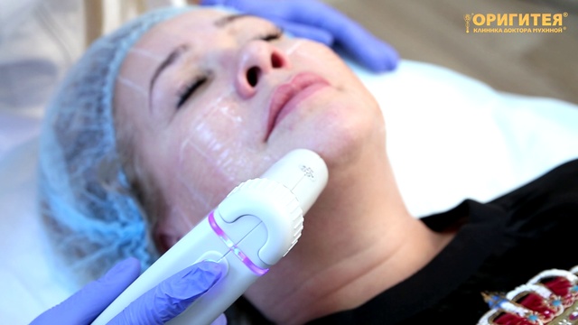  Оригитея: SMAS лифтинг