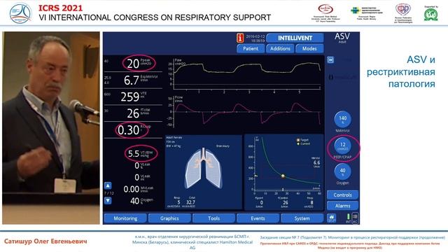 Протективная ИВЛ при CARDS и ОРДС Сатишур О.Е. 2021
