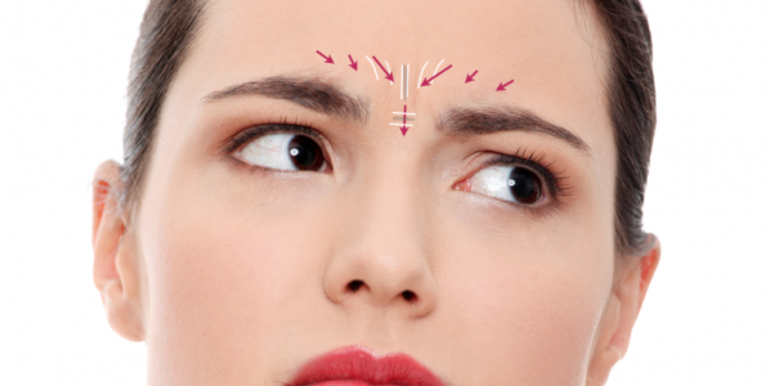 Межбровные морщины сотрет супер средство!!!.mp4