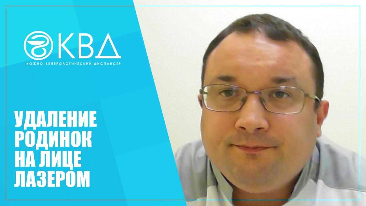 1276  Удаление родинок на лице лазером