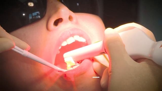 Медтуризм Республиканская стоматологическая поликлиника Минздрава Чувашии.mp4