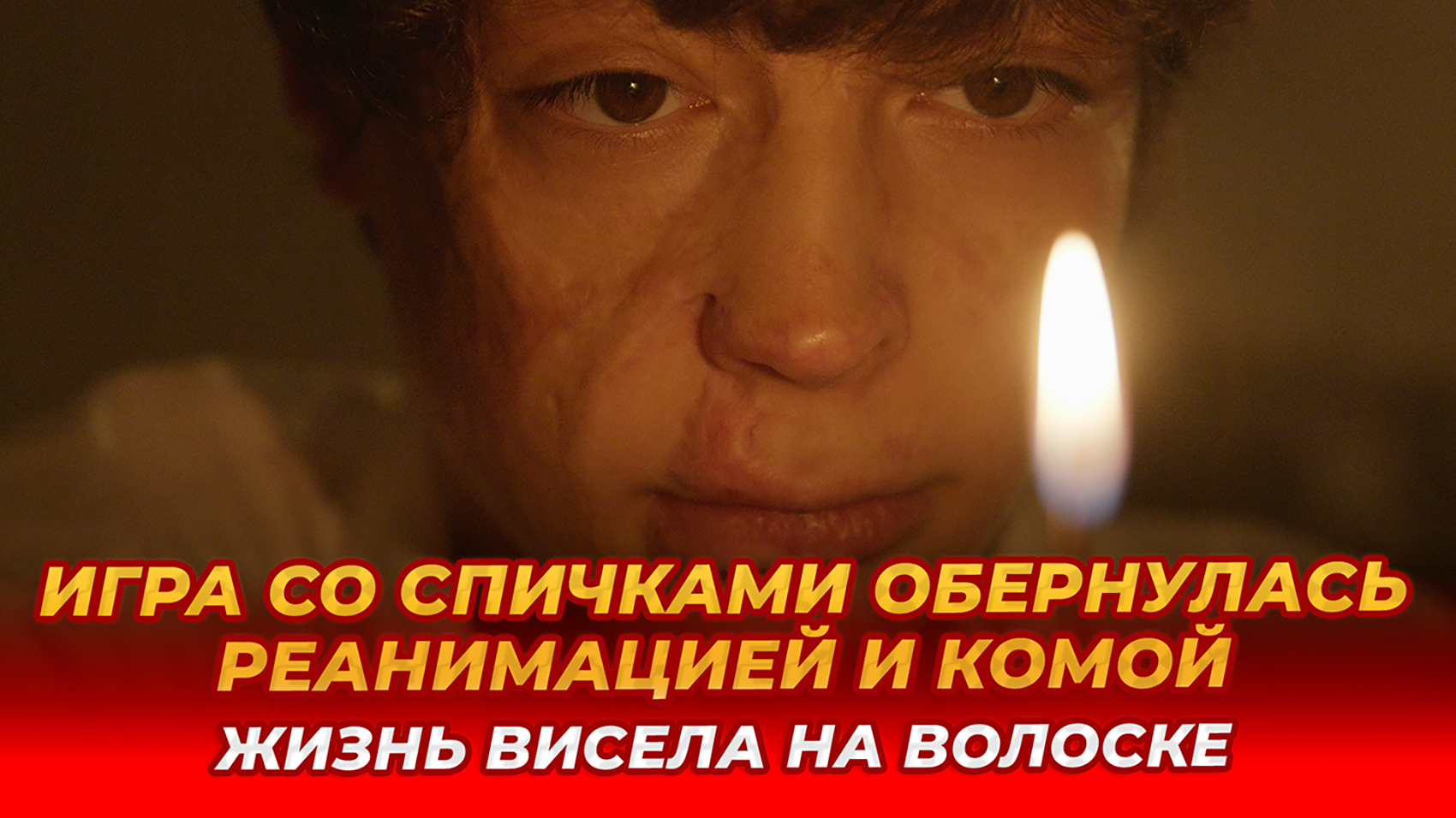 Игра со спичками обернулась реанимацией и комой. Жизнь висела на волоске